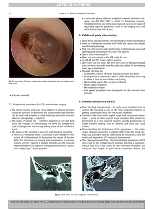 Getting started-in-endoscopic-ear-surgery | PDF