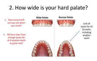 Geting to know your mouth better: Mouth, jaw and cheek exercises o ...