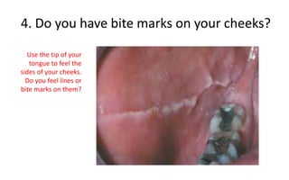 Geting to know your mouth better: Mouth, jaw and cheek exercises o ...