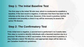 Get your TB skin test done in Square one, Mississauga easy and ...