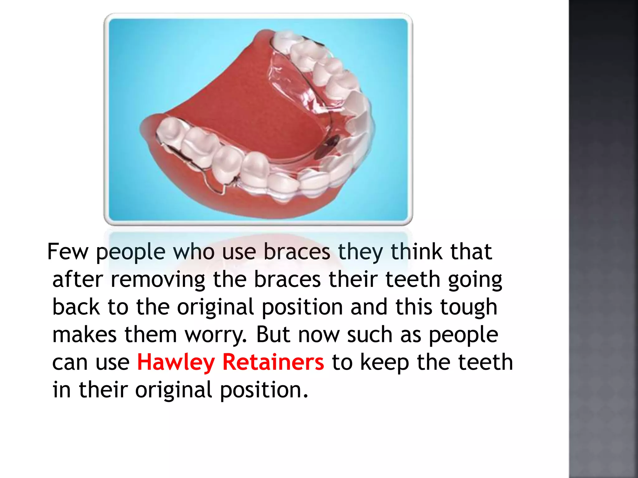 Get your teeth in original shape with retainers | PPTX