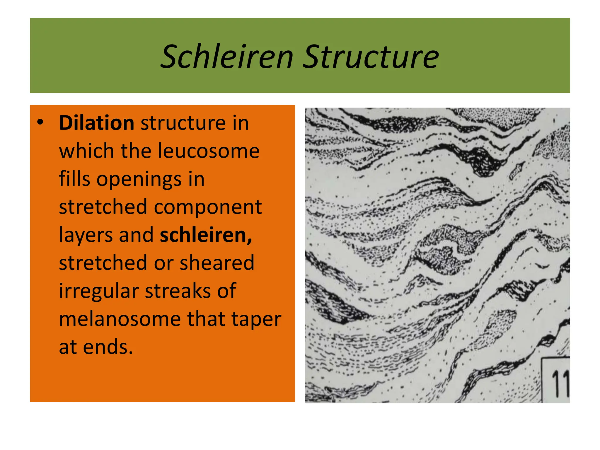 MIGMATITE (Igneous Petrology) [undergraduate] | PPTX