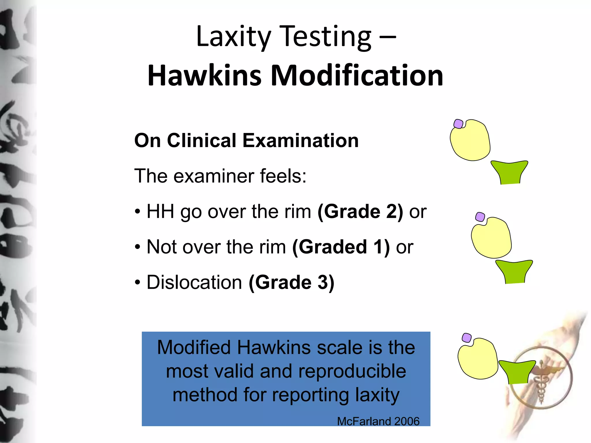 Chengdu instability clinical examination | PPTX