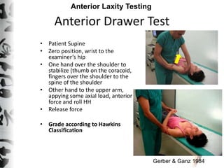 Anterior Drawer Test Shoulder