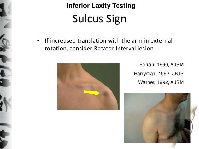 Chengdu instability clinical examination