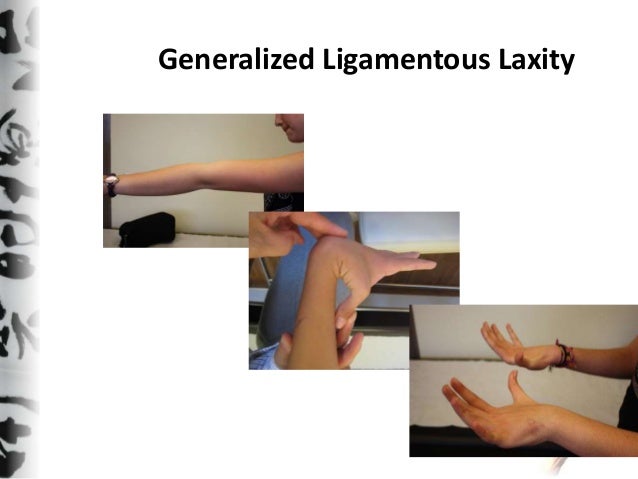 Chengdu instability clinical examination