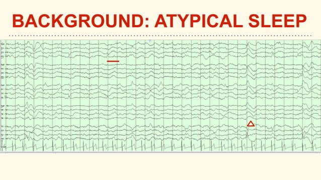 Continuous EEG in Neuro Critical Care by Brandon Foreman | PDF | Brain ...