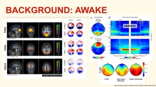 Continuous EEG in Neuro Critical Care by Brandon Foreman | PDF