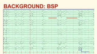 Continuous EEG in Neuro Critical Care by Brandon Foreman | PDF