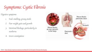 Cystic Fibrosis. Brief explanation | PPTX