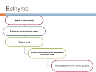 Ecthyma | PPTX