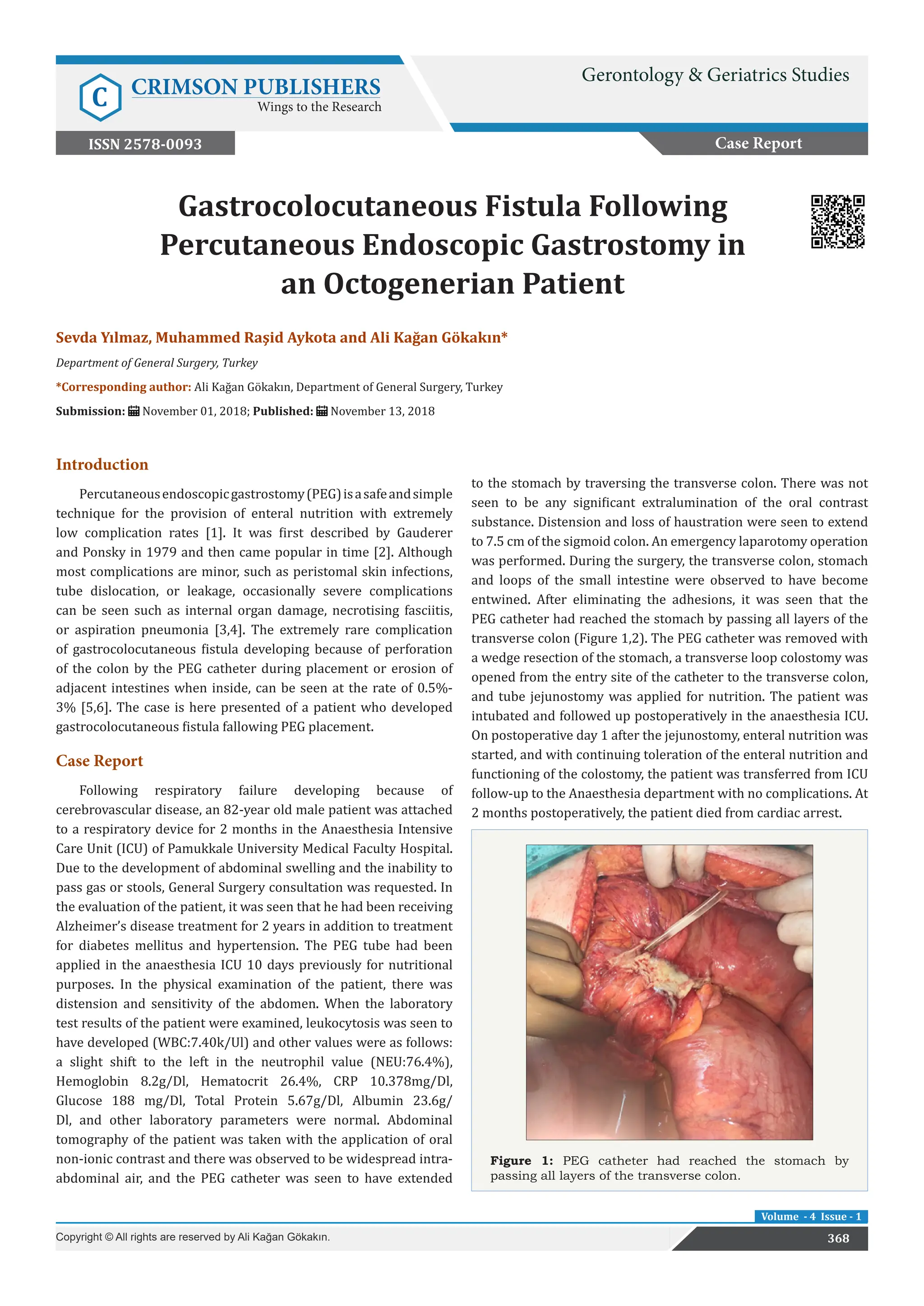 Gastrocolocutaneous Fistula Following Percutaneous Endoscopic ...