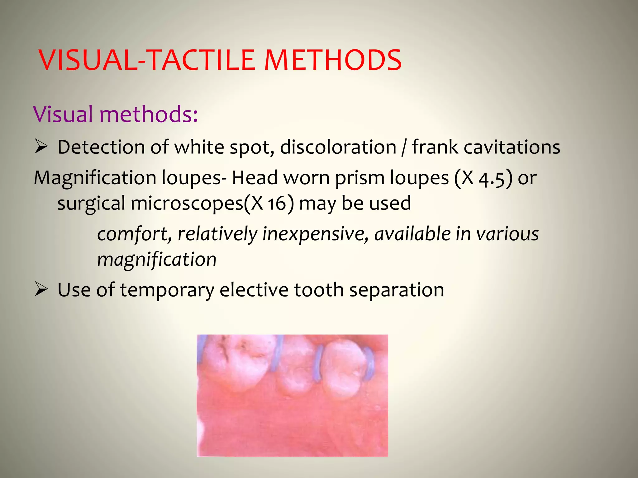 Detection and diagnosis of dental caries | PPTX