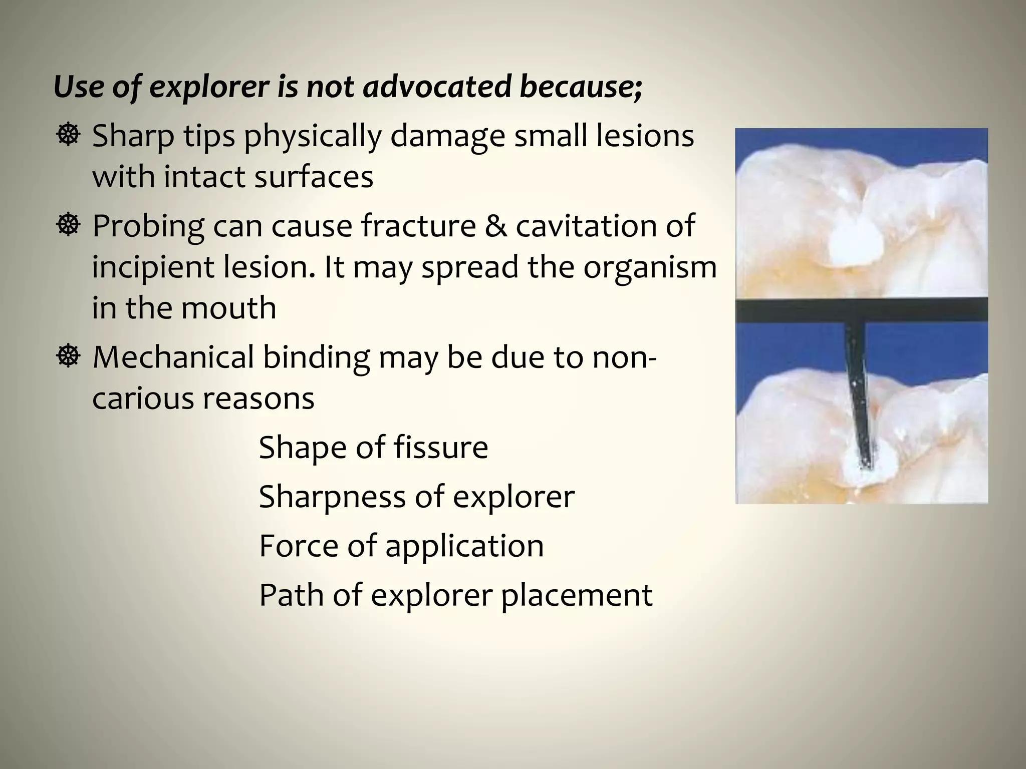 Detection and diagnosis of dental caries | PPTX