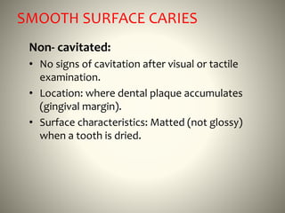 Detection and diagnosis of dental caries | PPTX