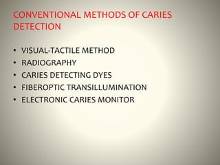 Detection and diagnosis of dental caries | PPTX