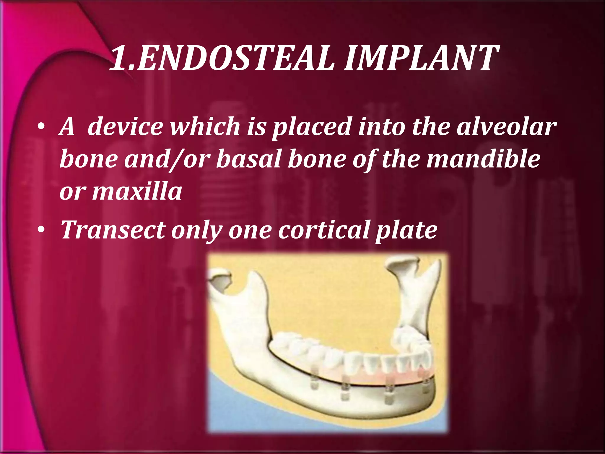 types and classification of dental implants | PPTX