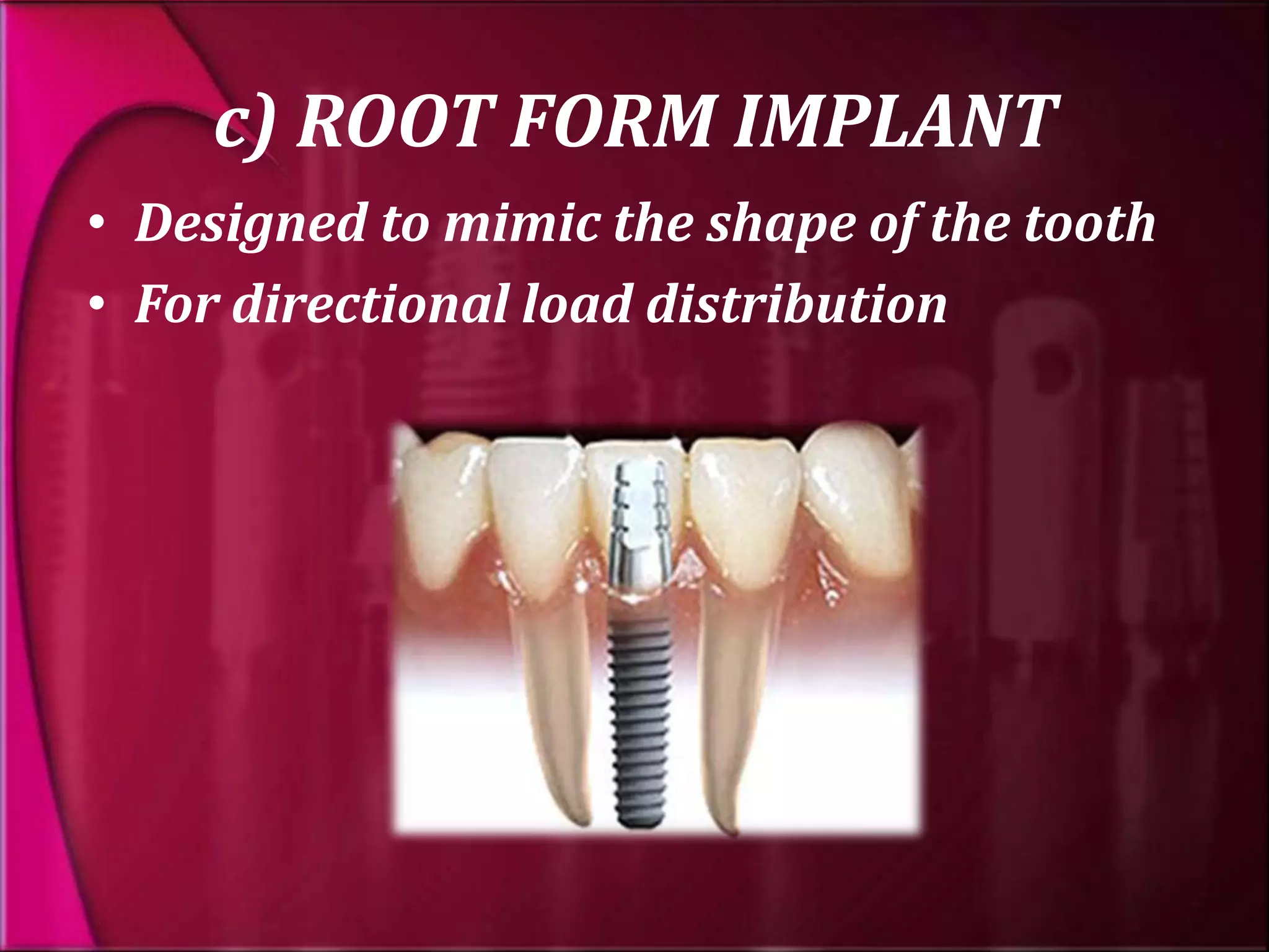 types and classification of dental implants | PPTX