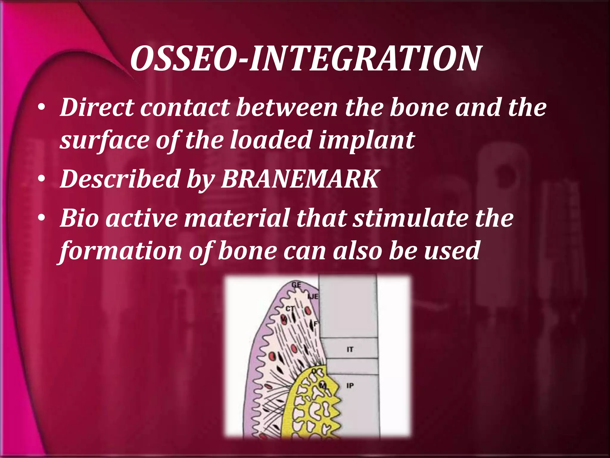 types and classification of dental implants | PPTX