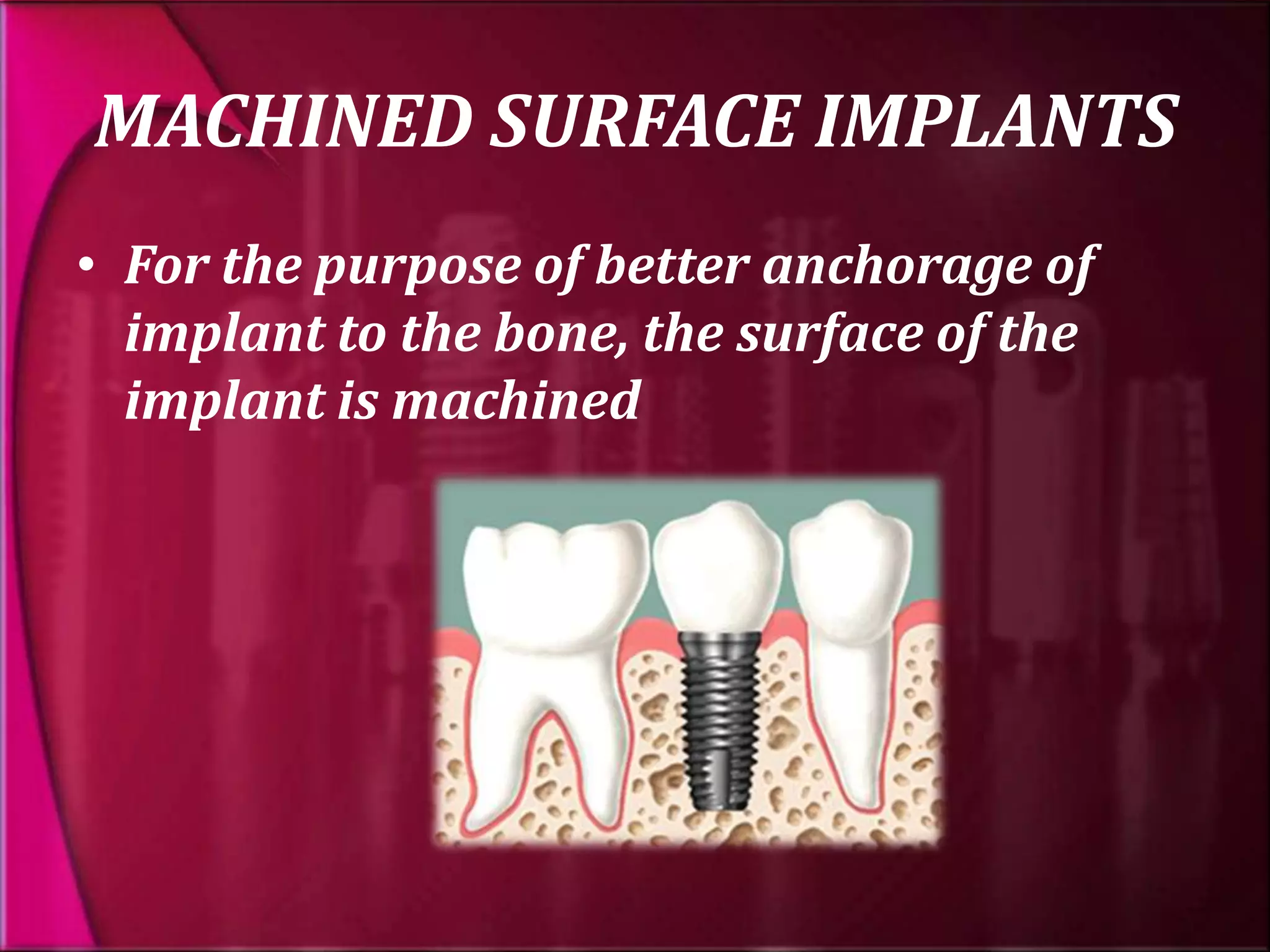 types and classification of dental implants | PPTX