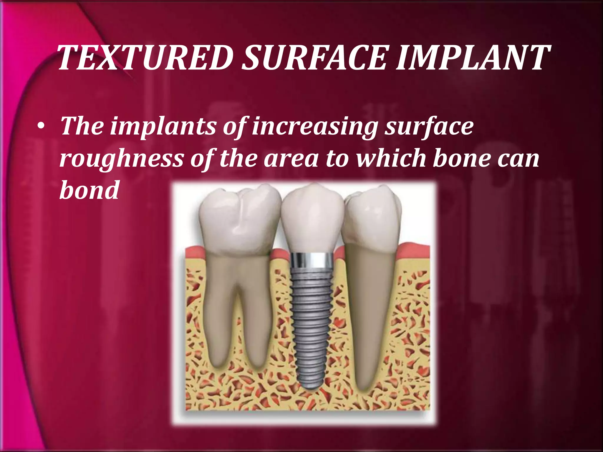 types and classification of dental implants | PPTX