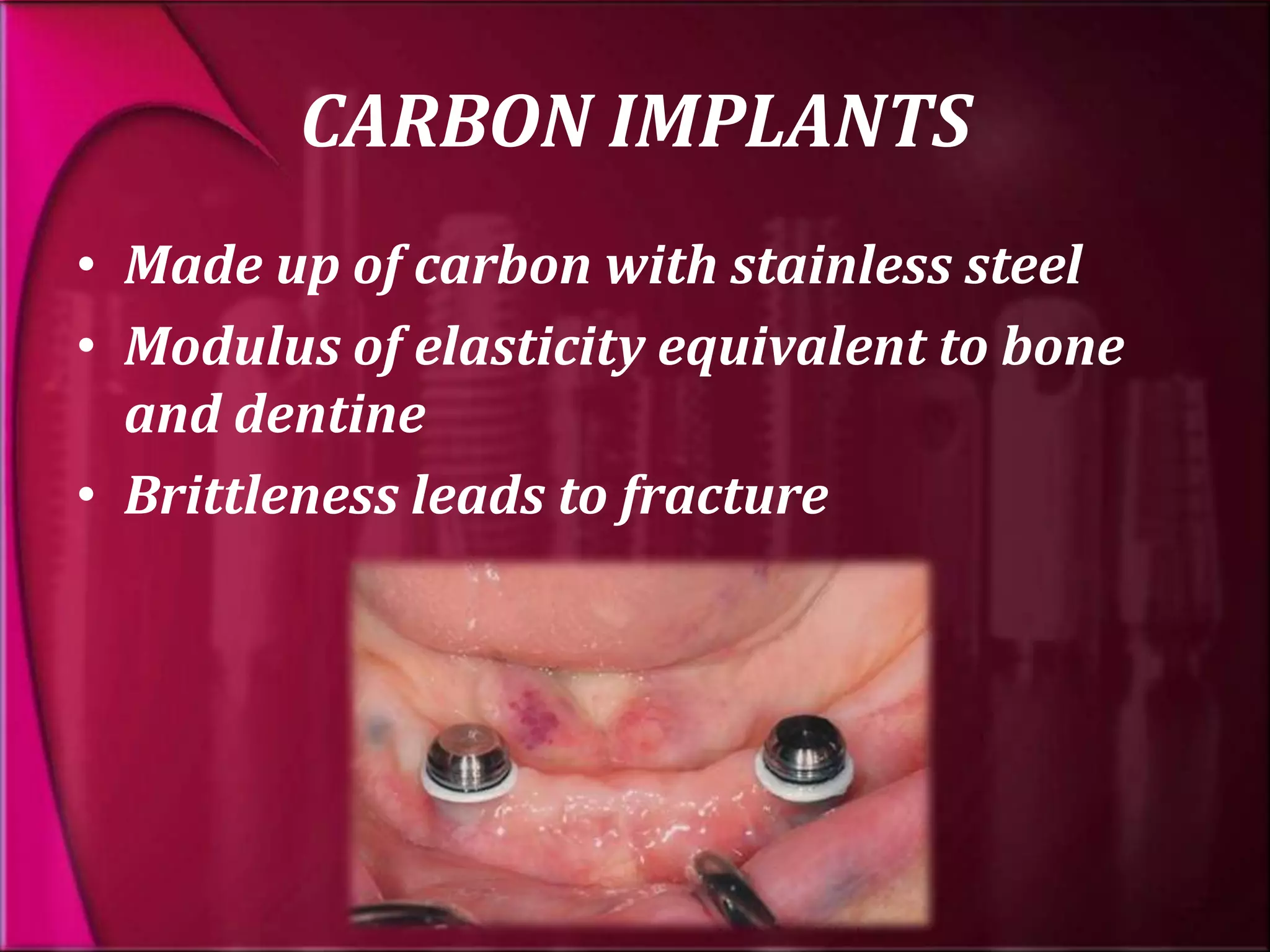 types and classification of dental implants | PPTX