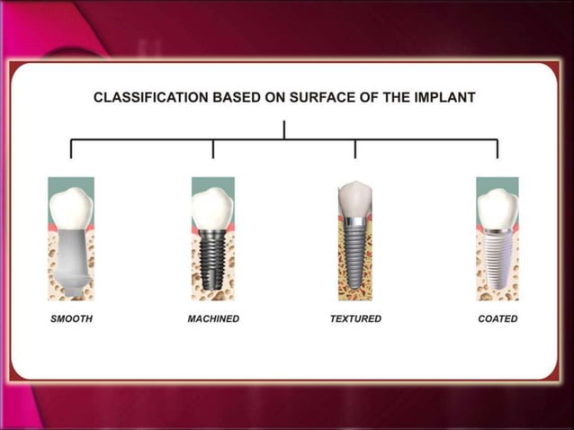 types and classification of dental implants | PPTX | Operating Systems ...