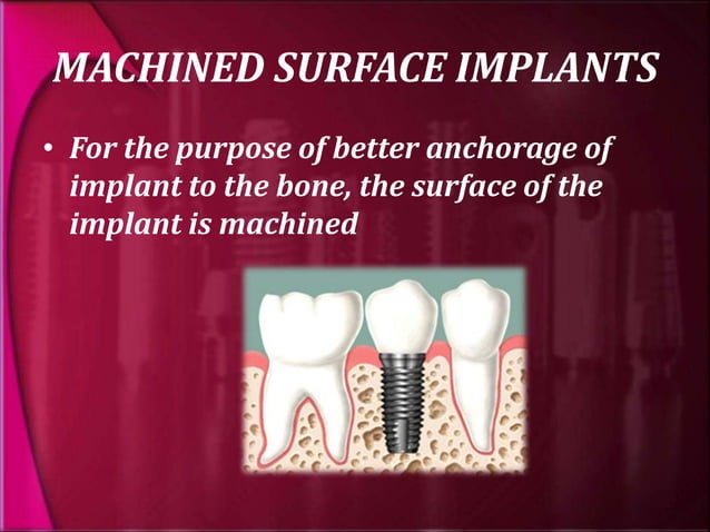 types and classification of dental implants | PPT