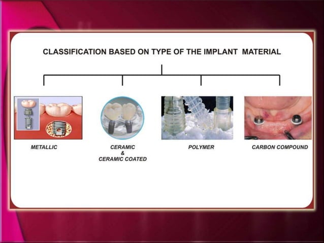 types and classification of dental implants | PPT