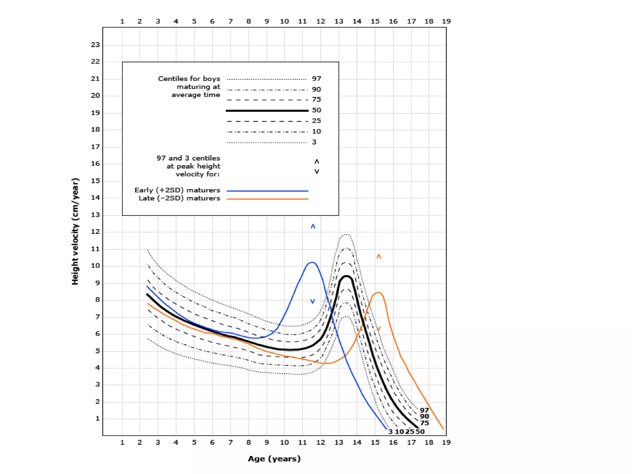 Growth Hormone Deficiency in Children | PPTX