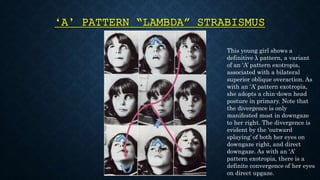 Ghostdogg productions present ~ alphabet pattern strabismus online ...