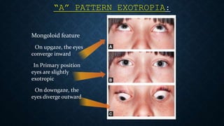 Ghostdogg productions present ~ alphabet pattern strabismus online ...