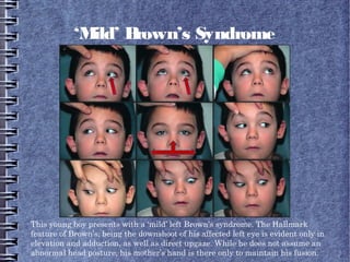 Ghostdogg productions presents browns syndrome online version 2-1 | ODP ...