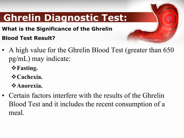 Ghrelin and Leptin hormones | PPTX | Endocrine and Metabolic Diseases ...