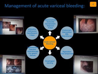 GI-Bleeding.ppt