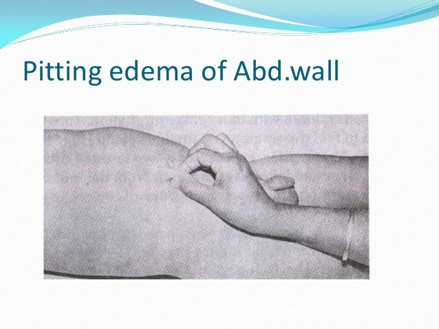 Gi exam by Dr.M.Mujeebullah