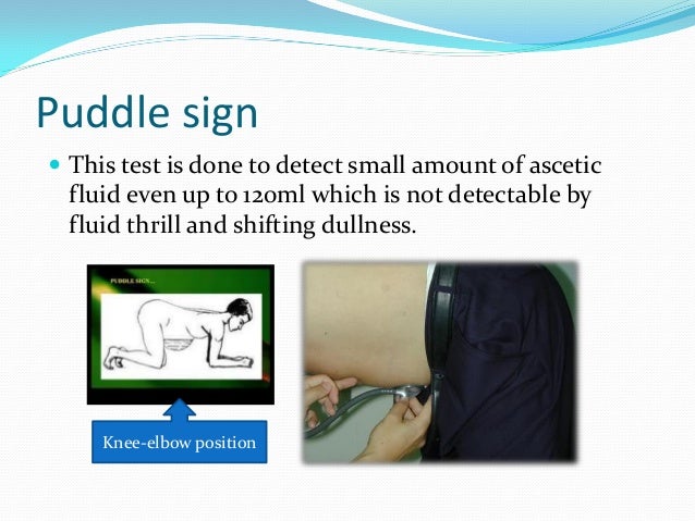 Gi exam by Dr.M.Mujeebullah