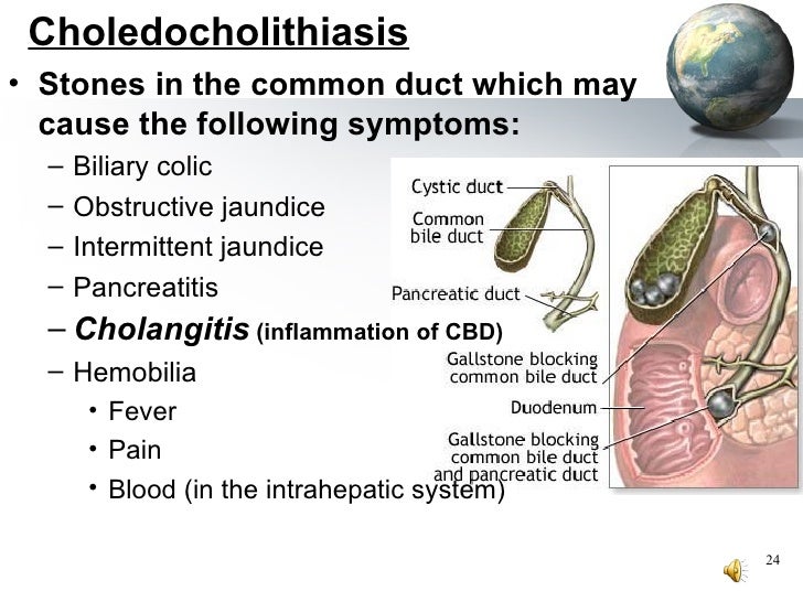 Cholangitis Meaning