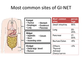 Gastro-Intestinal Neuro Endocrine Tumor | PPTX