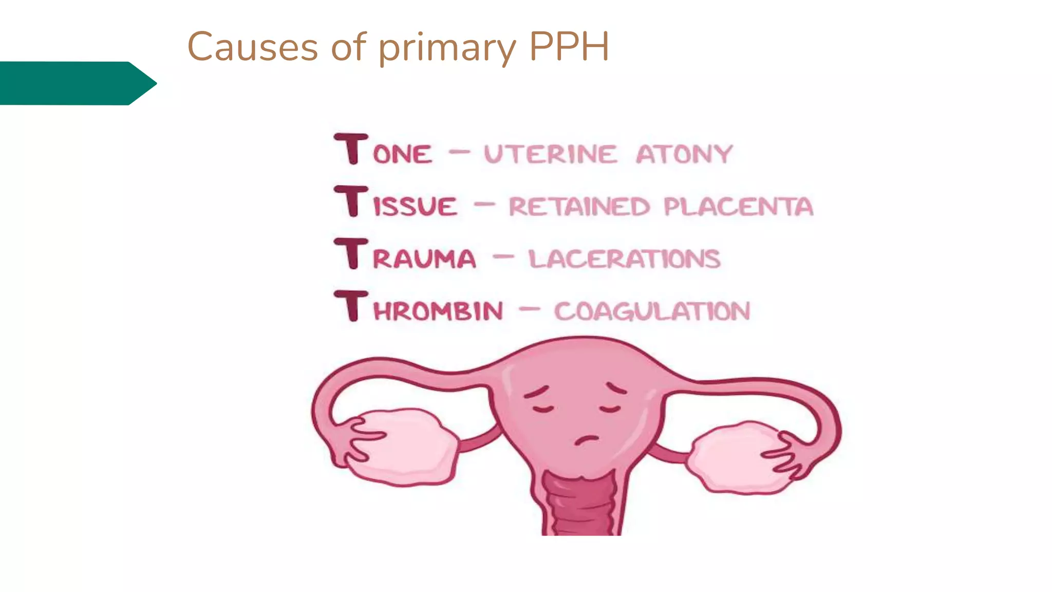 Postpartum_Hemorrhage_By_dr.Redwan.pptx