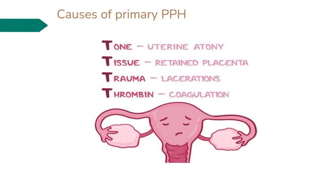 Postpartum_Hemorrhage_By_dr.Redwan.pptx