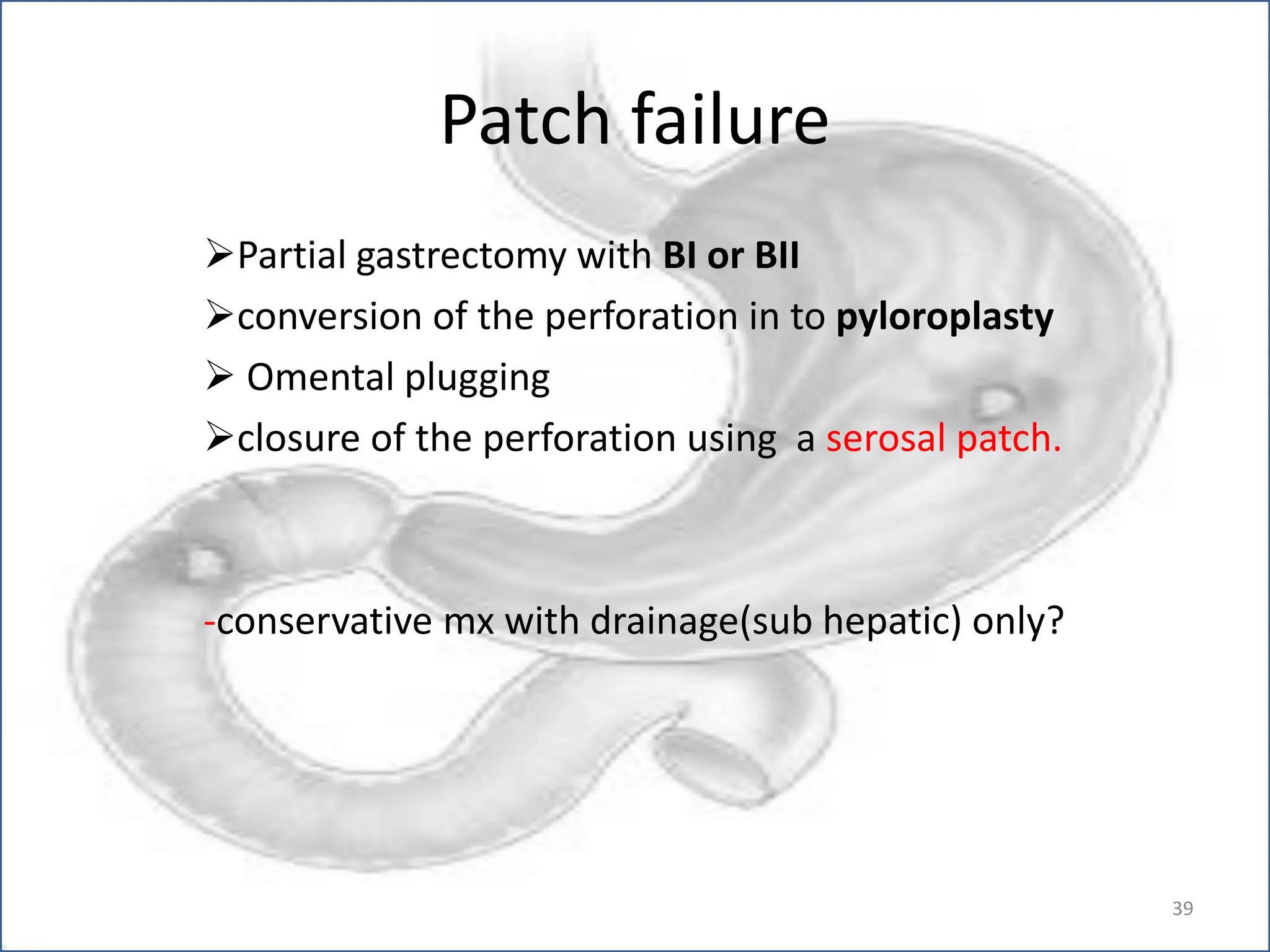 GI1. Surgical Management of PUD 2021.pptx
