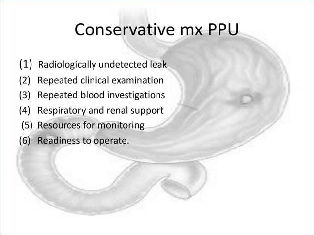 GI1. Surgical Management of PUD 2021.pptx