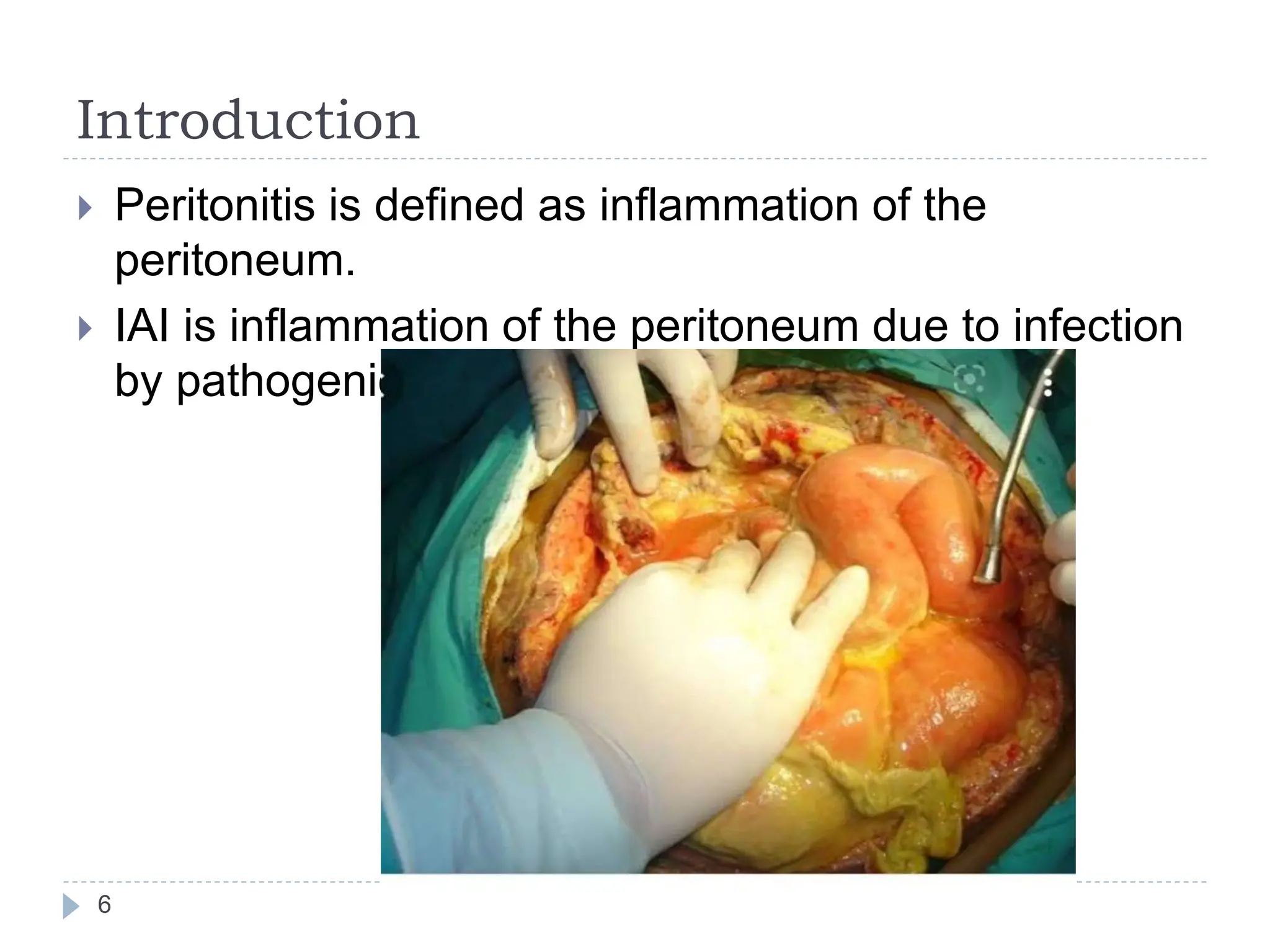 GI10. Peritonitis 202bbbbbbbbbbbb1 (2).pptx
