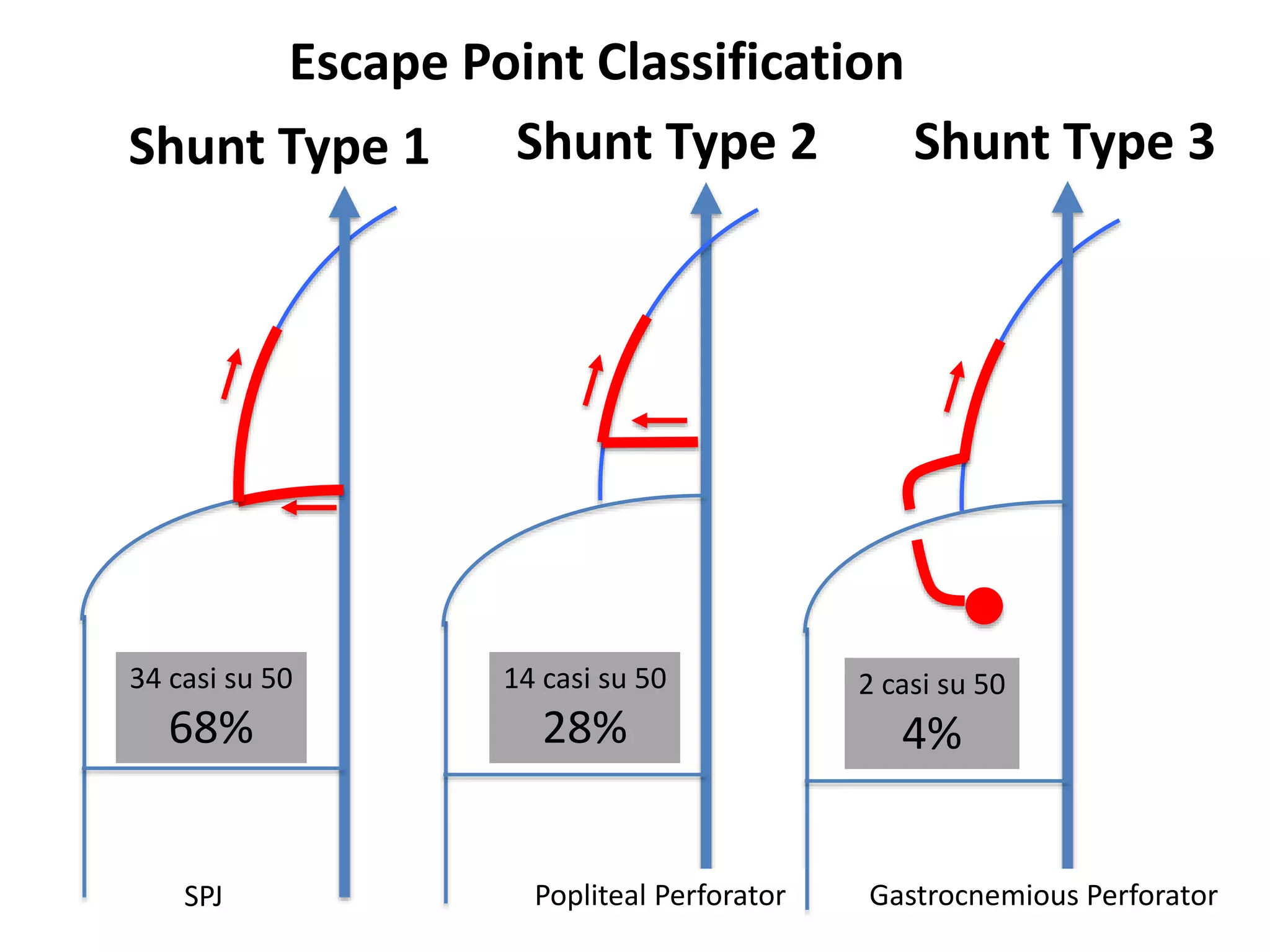 GIACOMINI VARICOSE VEINS ORIGINATING FROM THE POPLITEAL FOSSA | PPTX