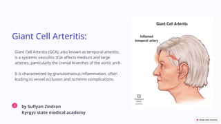 Giant-Cell-Arteritis-A-Comprehensive-Overview.pptx