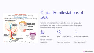 Giant-Cell-Arteritis-A-Comprehensive-Overview.pptx
