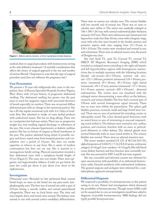 Giant-hydra-headed-uterine-fibroid-in-a-nullipara-a-case-report.pdf