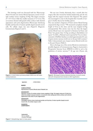 Giant-hydra-headed-uterine-fibroid-in-a-nullipara-a-case-report.pdf