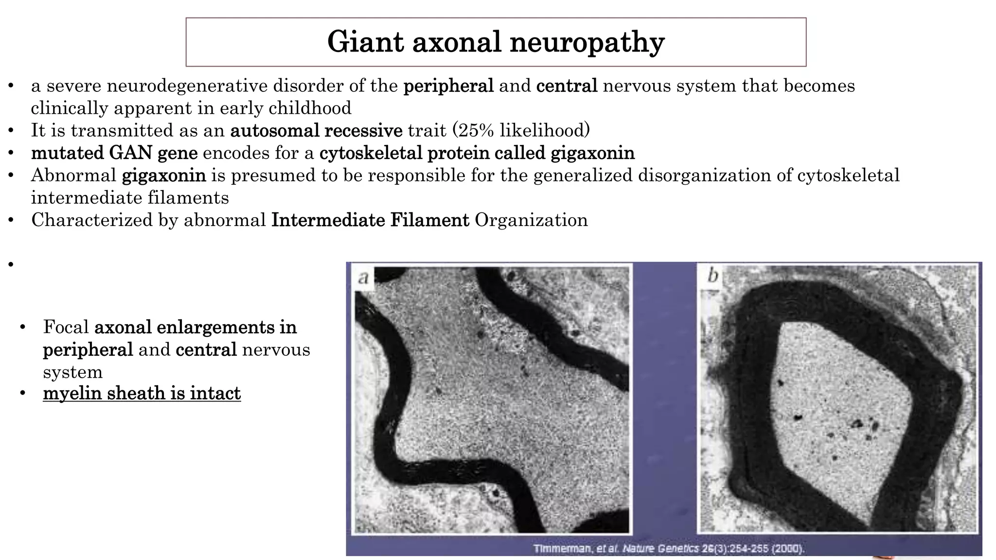 Giant axonal neuropathy | PPTX